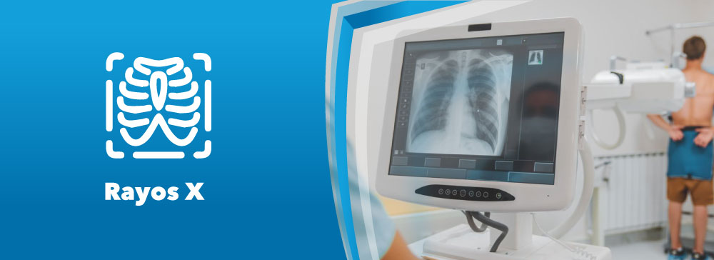 Rayos X - MiniMed